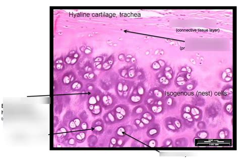 Hyaline Cartilage Trachea Labeled