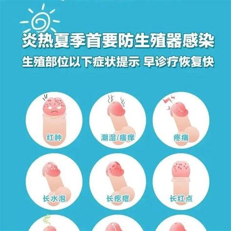 男科科普 炎热夏季，生殖部位感染炎症有哪些症状？下图提示↓↓↓黎平侵权图文