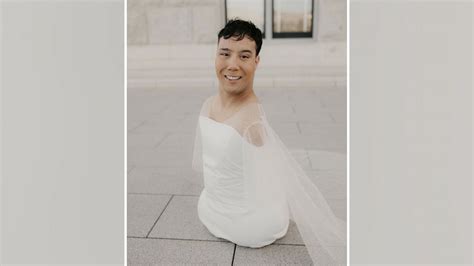 Famous Man Without Arms And Legs At Francis Holston Blog