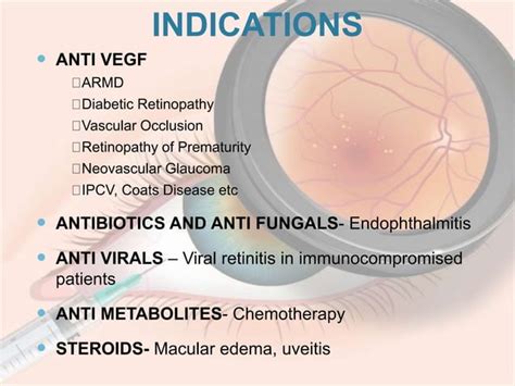 Intravitreal Injection Ppt