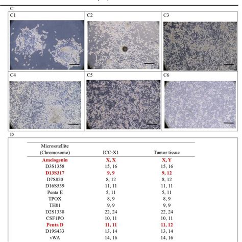 Clinical Data Morphology Short Tandem Repeat Str Detection And