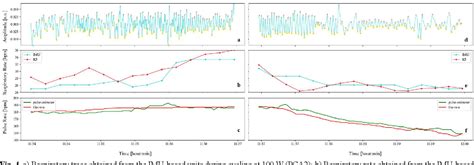 Figure 4 From A Wireless Body Sensor Network For Cardiorespiratory