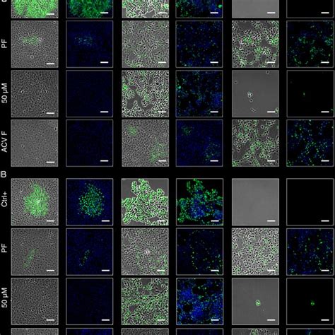 A Schematic Of Singlet Oxygen Aggregation Caused Quenching Acq Download Scientific Diagram