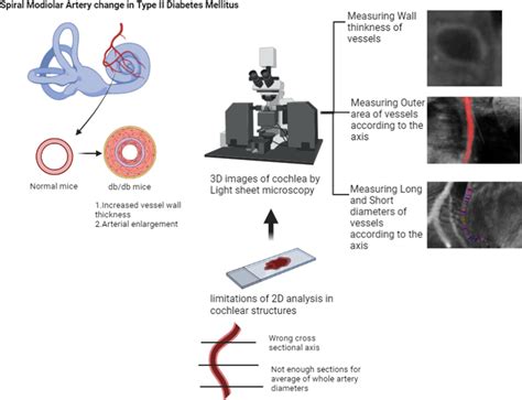 Three‐dimensional Analysis Of The Spiral Modiolar Artery Sma In The Download Scientific