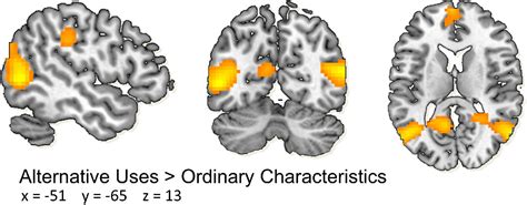 Figure 1 From The Relation Between Resting State Connectivity And Creativity In Adolescents