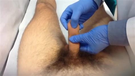 Medical Male Genital Exam Video 2