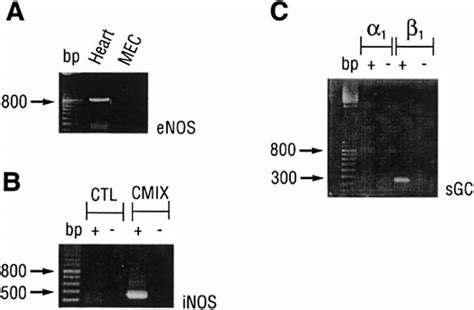 Nitric Oxide Synthase Nos And Soluble Guanylyl Cyclase Sgc