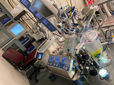 Bypass Machine Ups Bypass