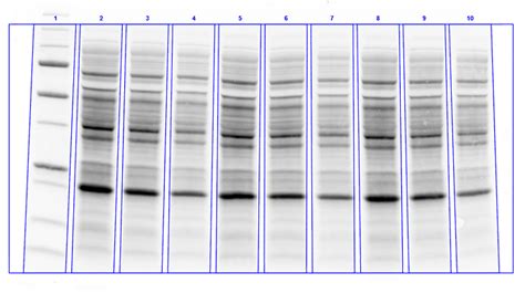 Protein Electrophoresis And Blotting Equipment Bio Rad