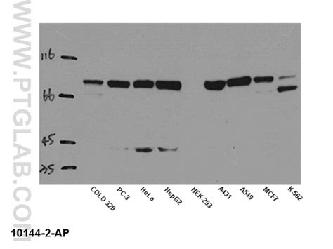 Ifn Gamma R2 Antibody 10266 1 Ap Proteintech
