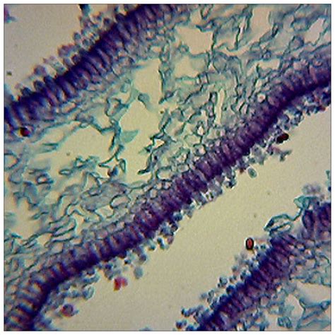 Microscope Slide Coprinus Mushroom