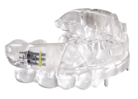Types Of Oral Appliances Cumming Ga Anti Snoring Device Sleep