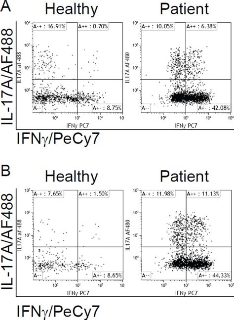 Video Lymphocyte Isolation From Human Skin For Phenotypic Analysis And Ex Vivo Cell Culture
