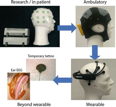 13 An Overview Of Eeg Modalities With Reducing Size And Increased Download Scientific Diagram