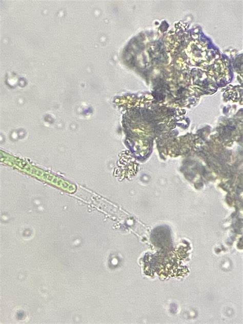 Cyanobacteria Under Microscope