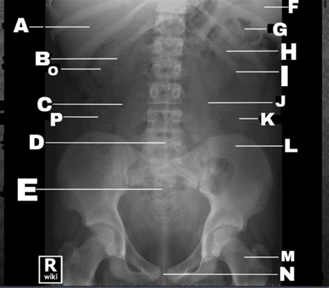Lab Exam 3 Flashcards Quizlet