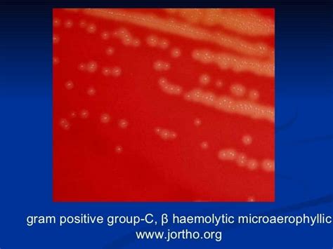 Streptococcus Constellatus Alchetron The Free Social Encyclopedia