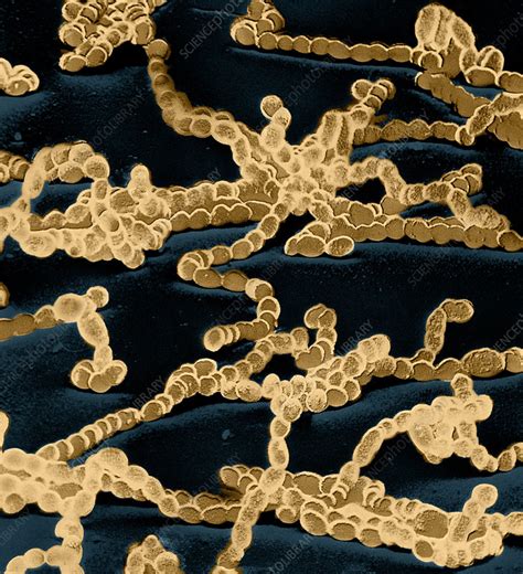 Streptococcus Bacteria SEM Stock Image C Science Photo Library