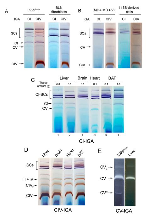 Isolation Of Mitochondria For Mitochondrial Supercomplex Analysis From Small Tissue And Cell