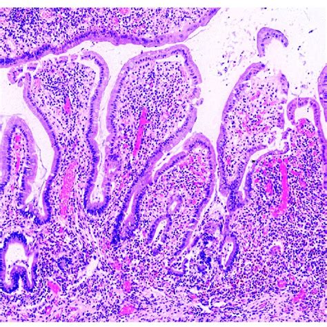 Relation Between P53 Immunohistochemical Patterns And Msi Download Scientific Diagram