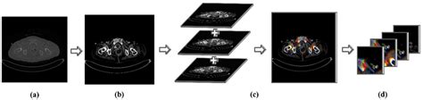 The Process Of Generating Synthesized Three Slice Data A An Original