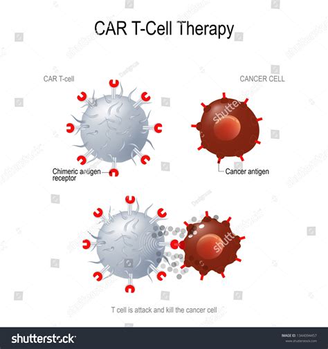 Car T Immunotherapy Artificial T Cell Stock Vector Royalty Free