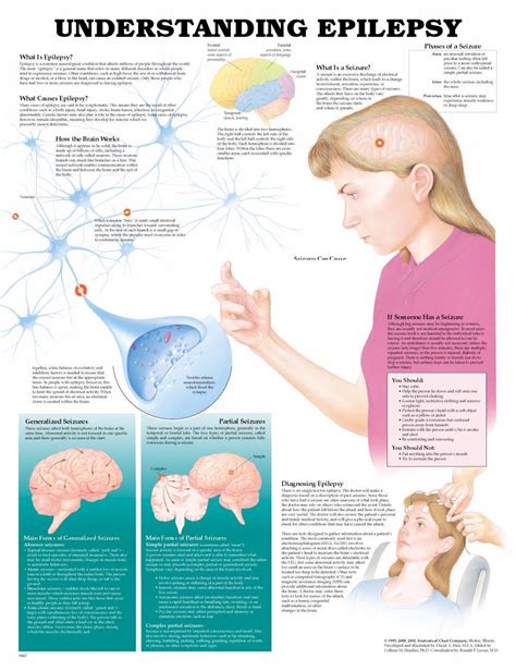 Seizure Types Chart Ponasa