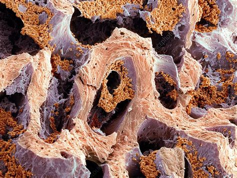 Bone Marrow SEM Stock Image P Bone Marrow Scanning Electron Micrograph