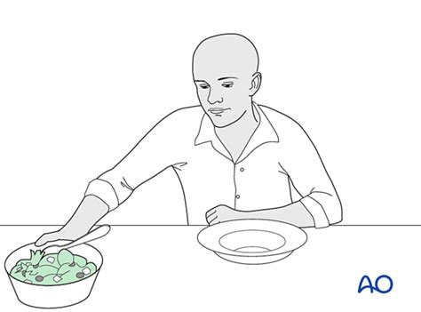 Nonoperative Treatment For Avulsion Of The Coracoid Process Nonoperative Treatment For Avulsion Of The Coracoid Process