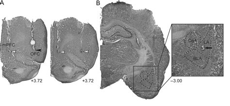 Figure 1 From Inhibitory Modulation Of Orbitofrontal Cortex On Medial Prefrontal Cortexamygdala