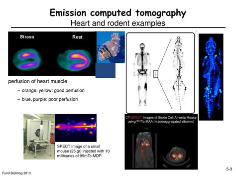 Ppt 5 Emission Computed Tomography Powerpoint Presentation Free