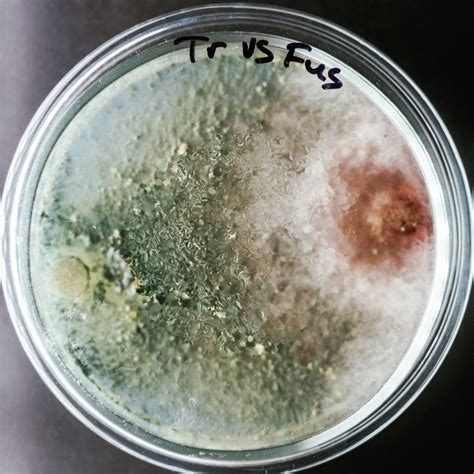 Std Testing Malaysia Fast Private And Reliable Screening He Medical Clinic