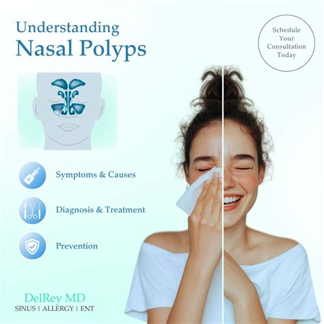 Nasal Polyp Causes Symptoms Treatment Nasal Polyp Nasal Polyps