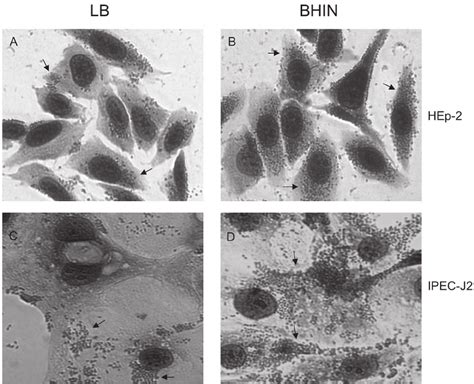 pattern of adherence to hep 2 a and b and ipec j2 c and d cells of