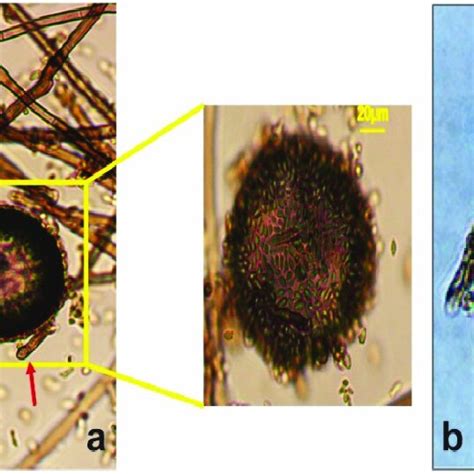 Molecular Identification Of Ampelomyces Quisqualis Species Of Its
