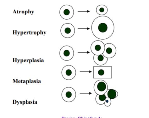 Neoplasia Flashcards Quizlet