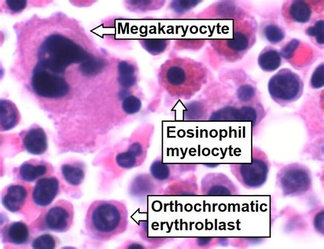 Platelets Histology Concise Medical Knowledge