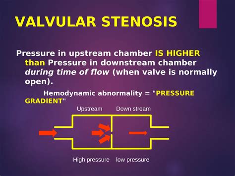Valvular Heart Disease Aortic Valve Disease Pdf