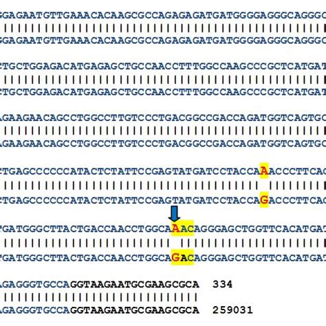 Alignment Of Exon In ESR Gene Sequence Of Women With Breast Cancer Download Scientific