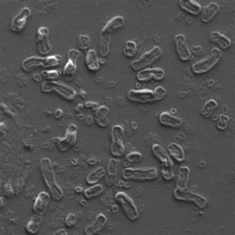 Boundless Bio Tests Cancer Drug Targeting Once Mysterious Dna Loops