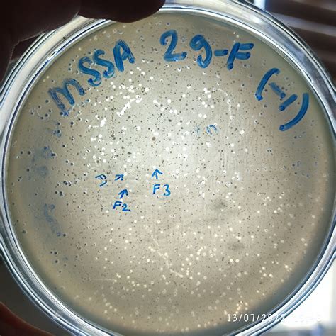 Staphylococcus Aureus Bacteriophage 152029f Mikroliz