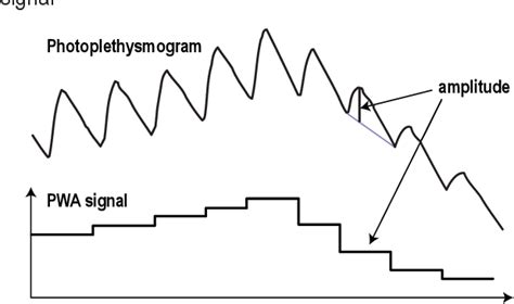 Figure 1 From Detection Of Sleep Disordered Breathing And Its Centralobstructive Character