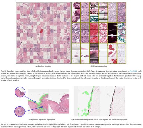 Paper Review Self Supervised Contrastive Learning For Digital Histopathology