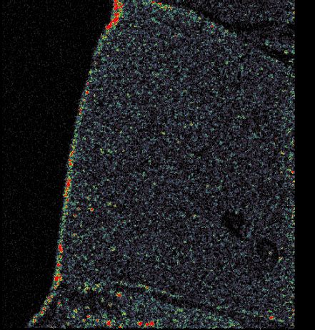 C Scan OCT Image Sample 5 Defects Between Dental Cavity And Composite Download Scientific