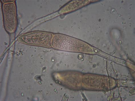 Misidentifying Fungi June