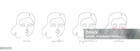 피부 타입 인포그래픽 벡터 한 줄 현대 그림 세트입니다 여드름 주름이 있는 여성 얼굴 아바타 색소 침착 발진 문제 색상 기호는 흰색으로 격리됩니다 스킨케어 헬스케어를 위한