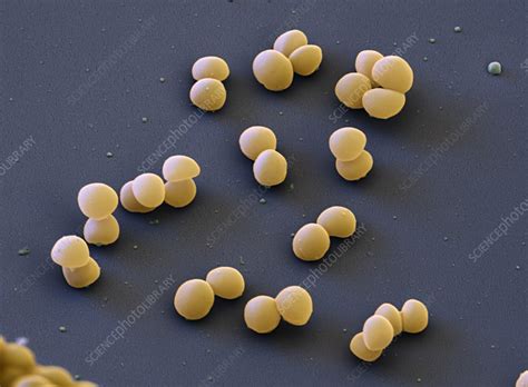 Staphylococcus Lugdunensis Bacteria Sem Stock Image C035 7900 Science Photo Library