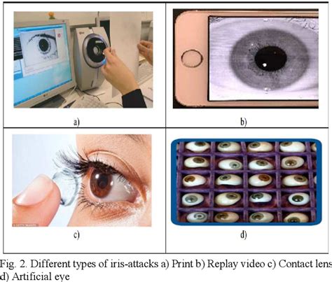 Figure 2 From Deep Learning Assisted Iris Liveness Detection Mechanisms Semantic Scholar