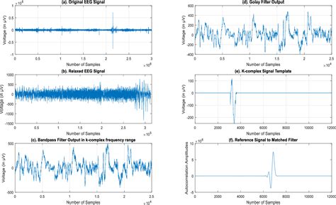 Figure 3 From Automatic Identification Of K Complex In Sleep Eeg Signal For Clinical Practice