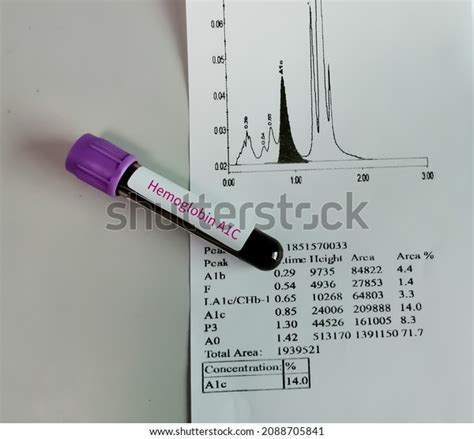 Blood Sample Hba1c Hemoglobin A1c Test Stock Photo 2088705841 Shutterstock